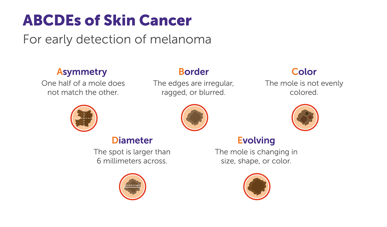Melanoma Clinic at MemorialCare Saddleback Medical Center | MemorialCare